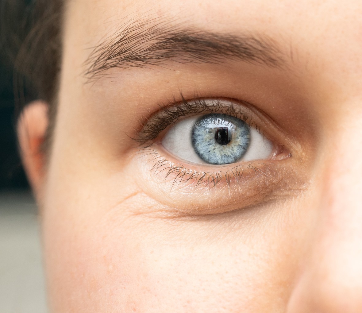 Eyelid Lift in Aurora | Give Your Eyes A Brighter & Refreshed Look